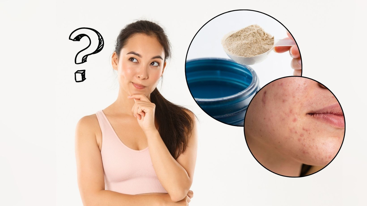 Descubra se Whey protein causa acne e outros 3 fatos que você não sabia ...